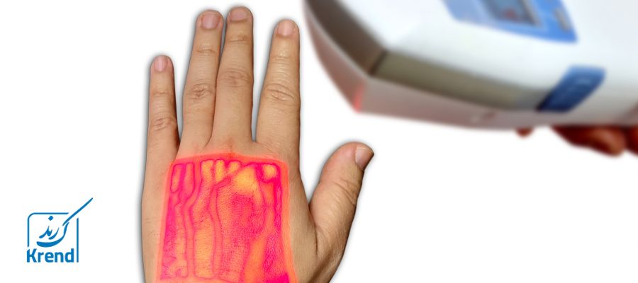 Everything You Need to Know About Infrared Vein Finders - KREND Medical ...